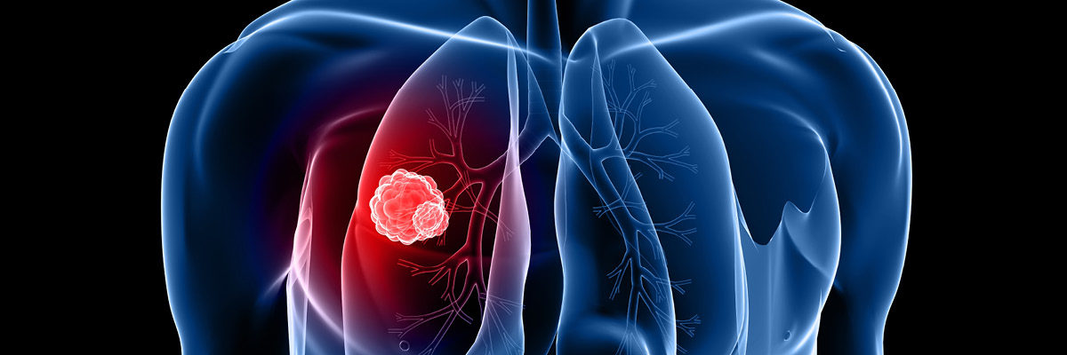 Biden Administration to Tighten Air Pollution Standards | Pollen.com